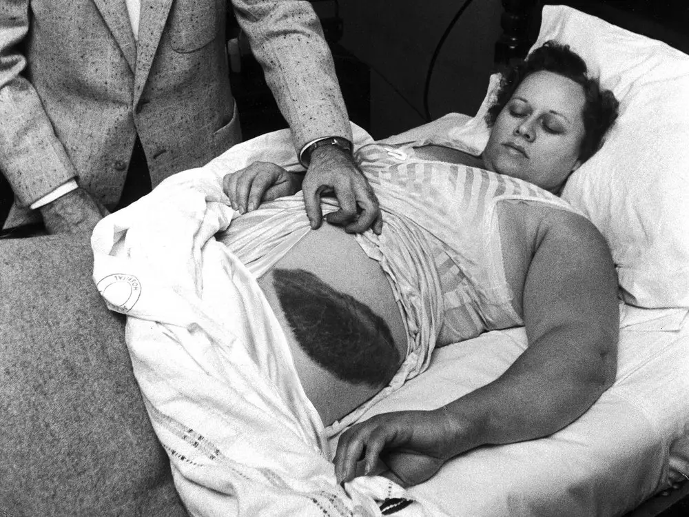 Aastal 1954 šokeeris maaväline verevalum seda Alabama naist