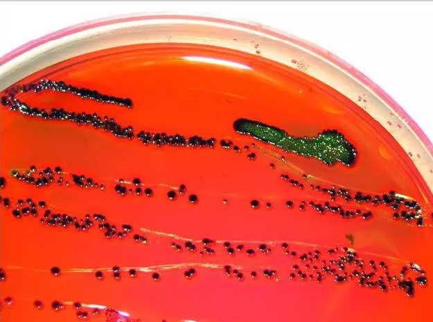 Un prim-plan cu E. coli care crește pe o placă Petri. Vasul are o soluție roșie aprinsă în el, iar bacteriile arată ca niște mărgele verzi mici grupate împreună.