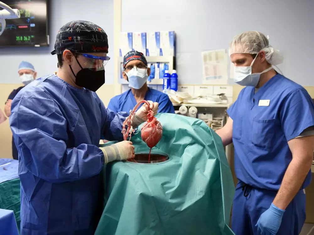 Група лекари в операционна зала, един лекар държи свинско сърце