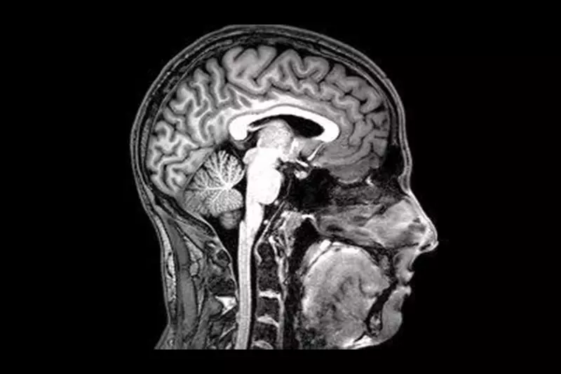 Siyah beyaz bir insan kafasının fMRI taraması. Tarama, fotoğrafın sağ kenarına bakan bir kişinin profiline aittir. Tarama beyin, beyin sapı, ağız ve burun gibi kafadaki tüm farklı organları vurgular.