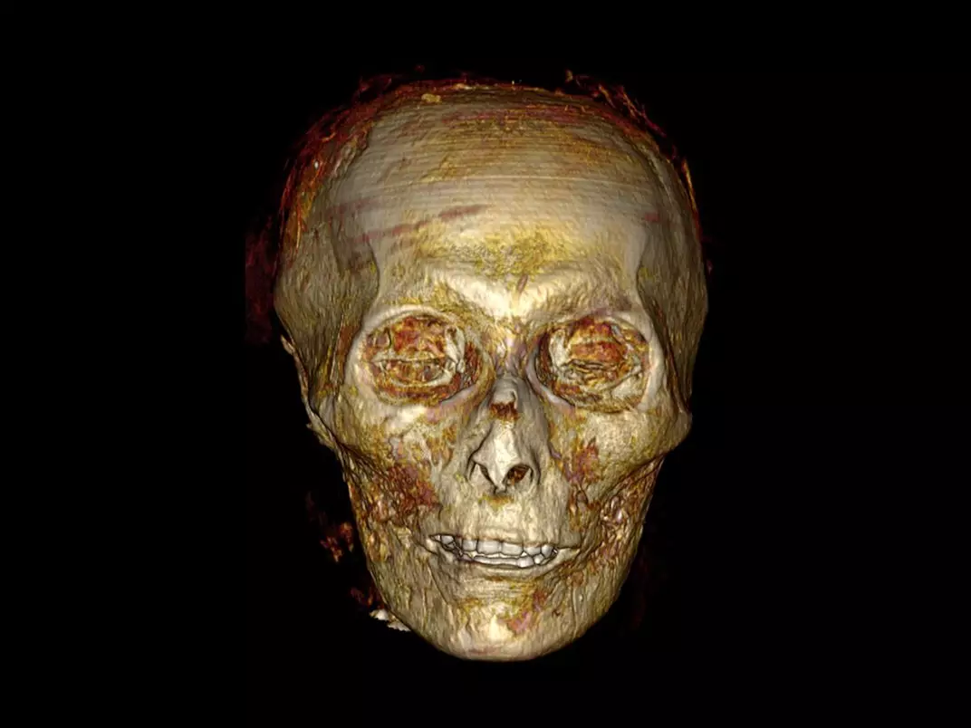 Scansione 3D del cranio