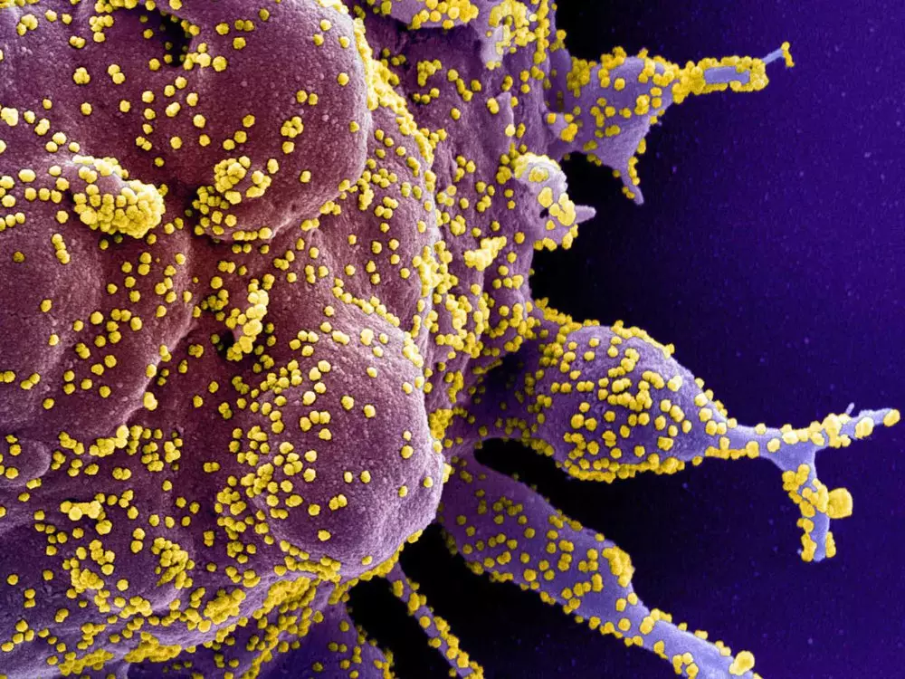 Coronavirüs Evrimleşerek Daha Az Ölümcül Olacak mı?