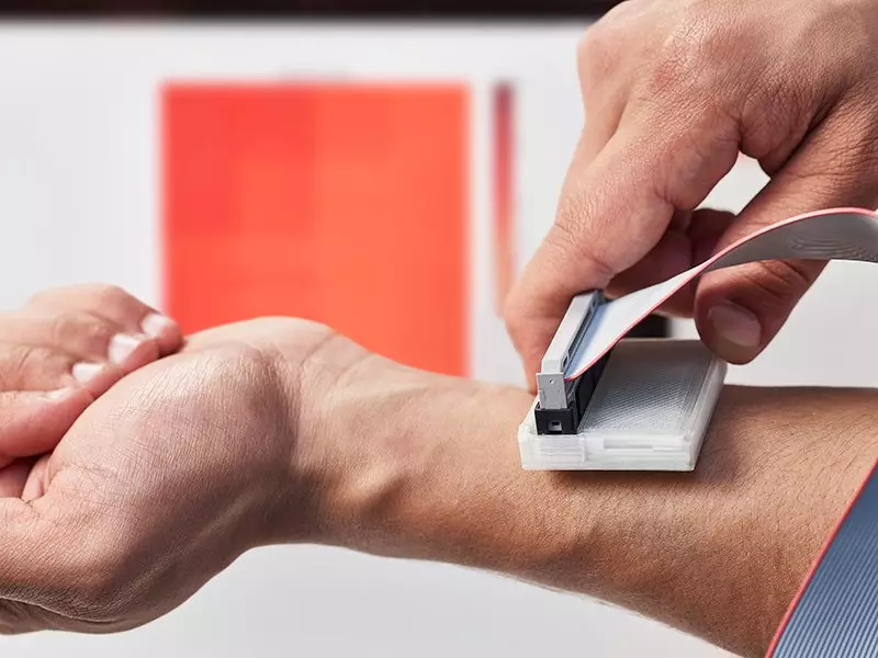 Este dispositivo de dixitalización barato podería detectar o cancro de pel cedo