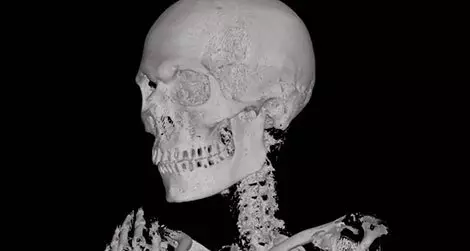 Scanóirí CT Crack Oscail Mystery Mummy