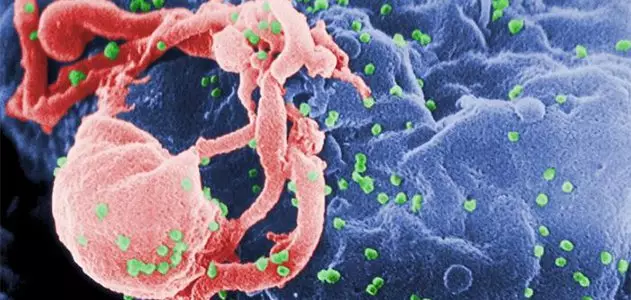 Entdeckt: En natierlecht Protein an der Mammemëllech dat géint HIV kämpft