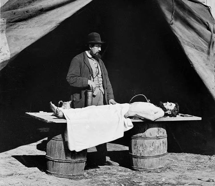 Een chirurg balsemt het lichaam van een soldaat tijdens de burgeroorlog