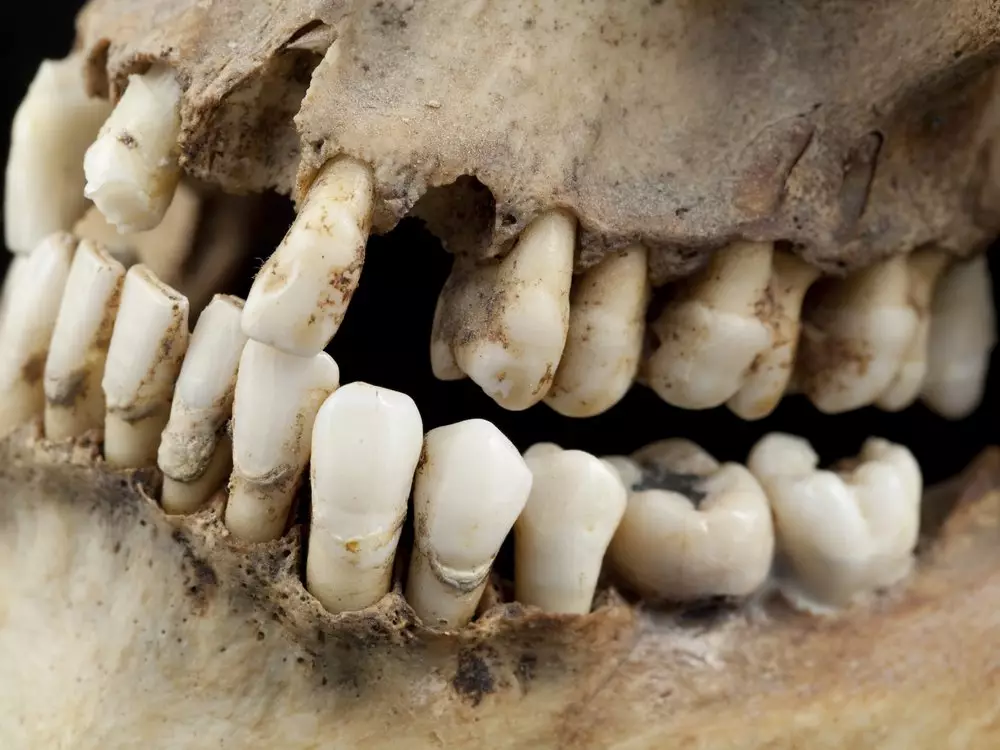 古代牙齿