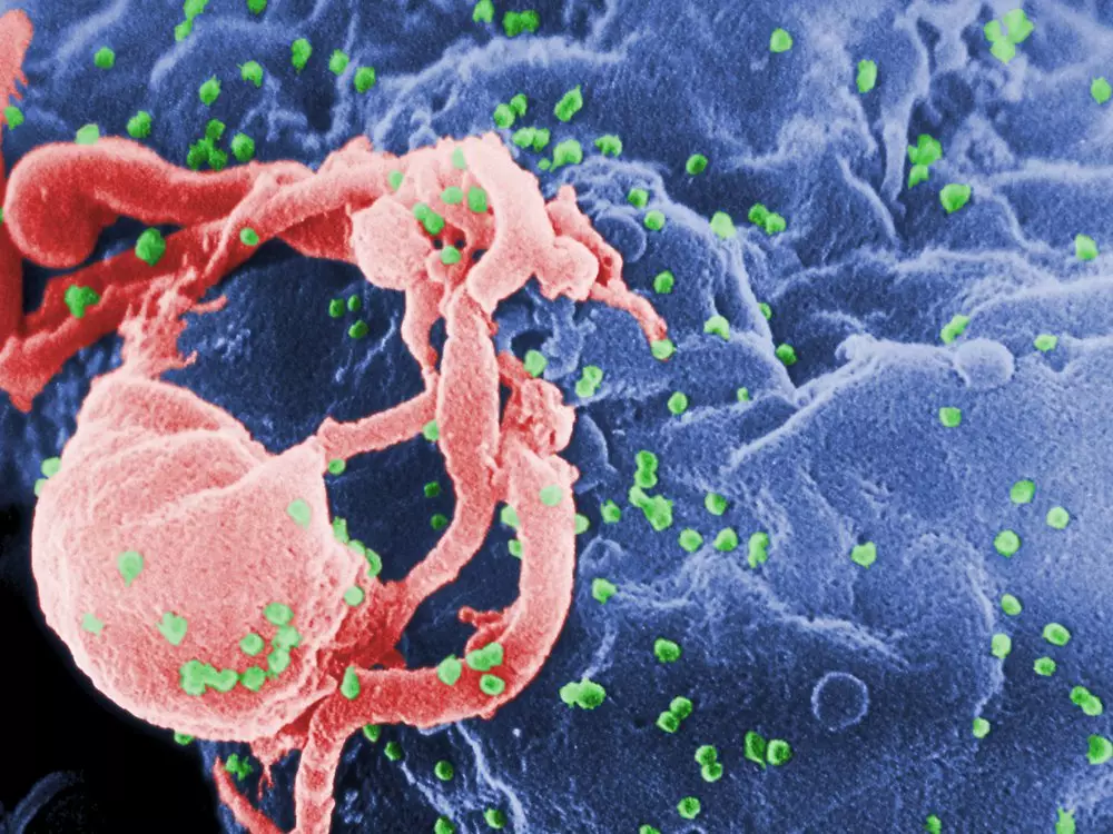 Генетычны вышук здымае з "нулявога пацыента" вінаватага ў эпідэміі СНІДу ў ЗША
