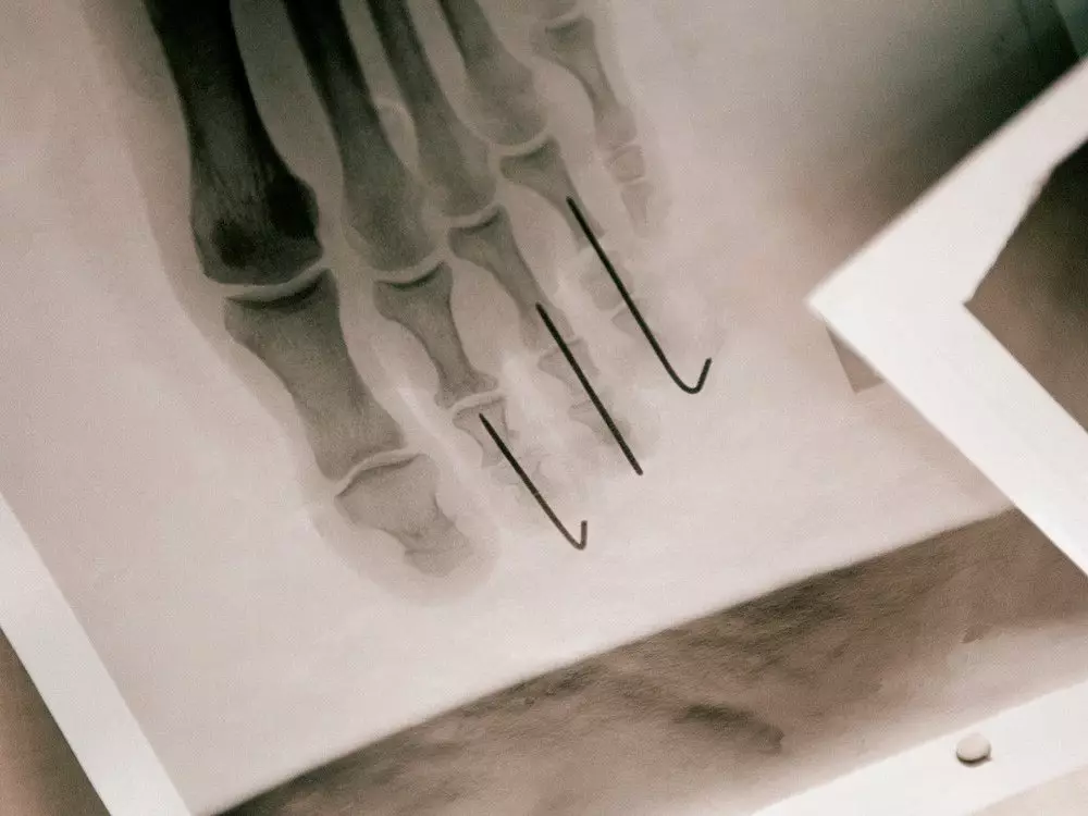 corp-mhodhnú-foot-x-ray.jpg