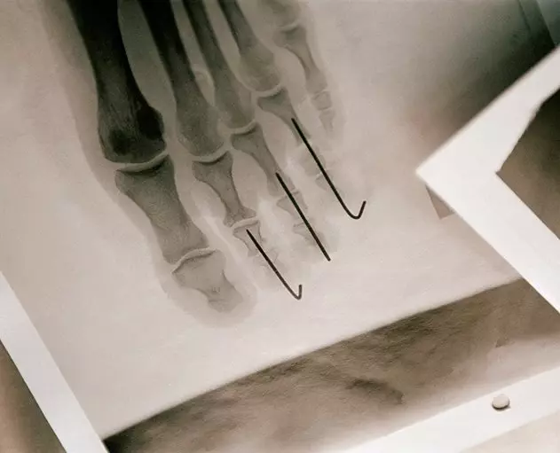 X-ray