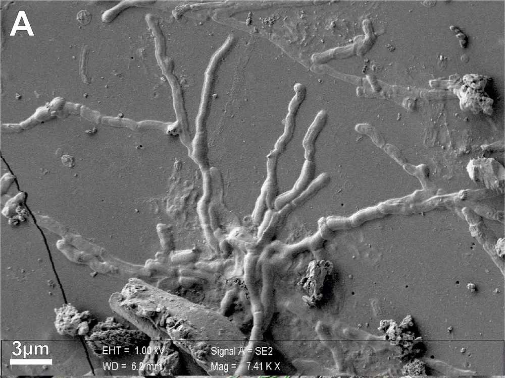 ภาพพื้นหลังสีเทาสองภาพที่มีใยเป็นเส้นเล็กๆ ที่ดูเหมือนภาชนะหรือรากของพืช เหล่านี้เป็นเซลล์สมองซึ่งเป็นเซลล์ที่ยาวขึ้น