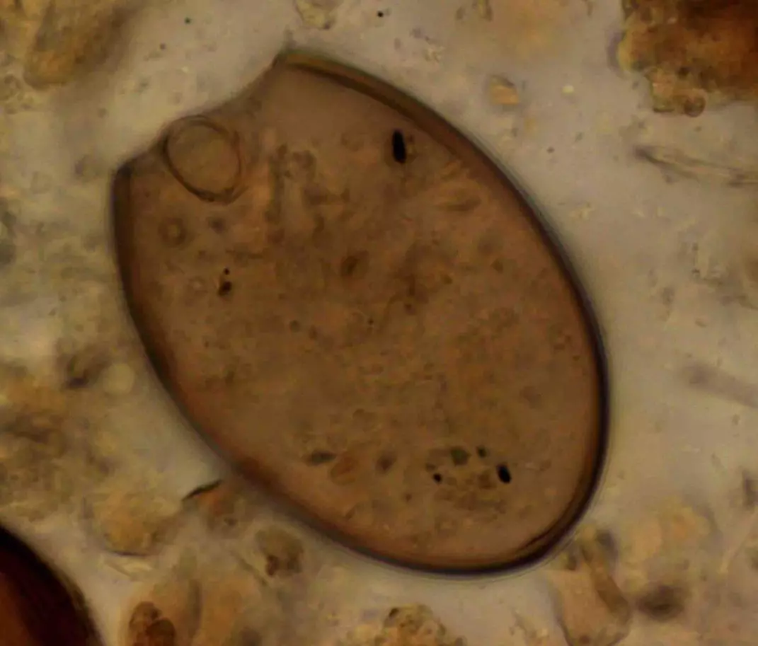 Microscopic fish tapeworm egg na matatagpuan sa medieval latrine sa Riga