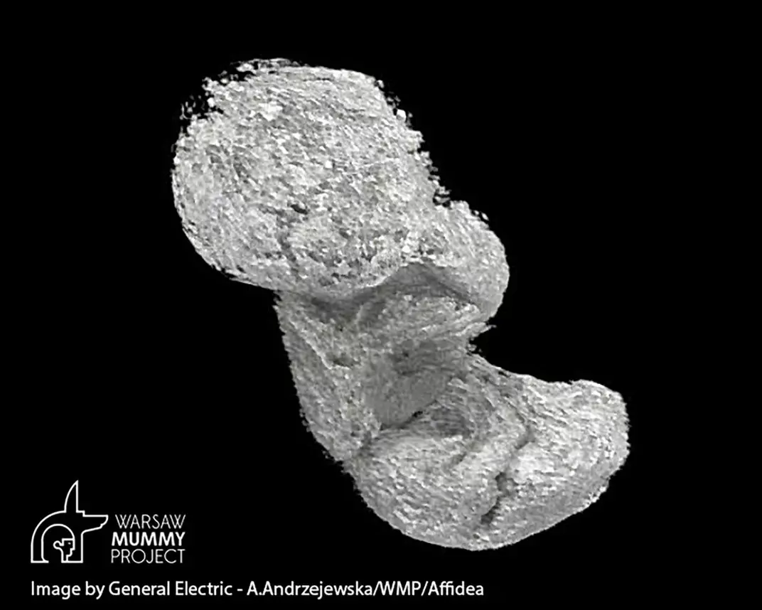 Ein schwarz-weißer 3-D-Scan des mumifizierten Fötus