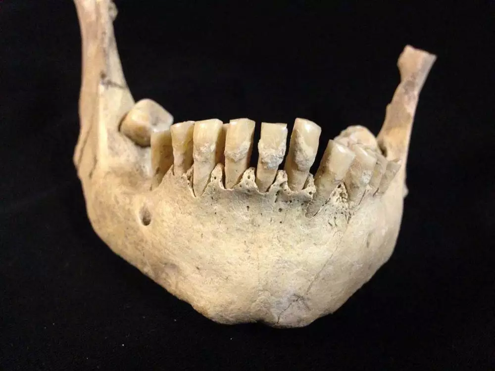 प्रागैतिहासिक किसानहरूको दाँत देखाउने मानिसले 6,000 वर्ष पहिले जनावरको दूध पिइरहेका थिए
