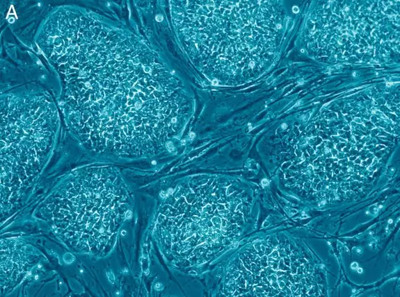 Os dous máis novos gañadores do Premio Nobel abriron a caixa de Pandora de investigación e clonación de células nai