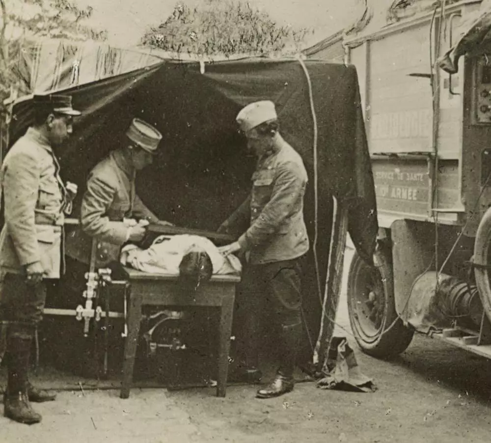 Egy francia első világháborús tábori kórház orvosai golyót keresnek röntgenkészülékkel