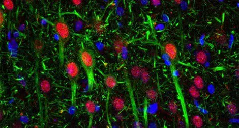 Hjärnceller, färgade i rött, är känsliga för hormoner som påverkar aptiten