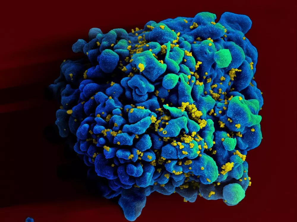 전자현미경으로 촬영한 HIV에 감염된 T 세포의 이미지. T 세포는 파란색 얼룩처럼 보이며 빨간색 배경에 있습니다. 파란색 구조를 둘러싸고 있는 작은 노란색 입자가 있습니다. 이들은 HIV 바이러스입니다.