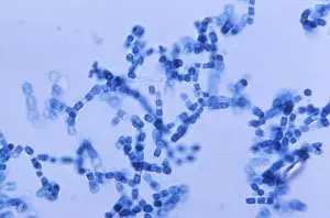 Umuriro Wibibaya: Fungal Spores Yibasiye Abacukuzi