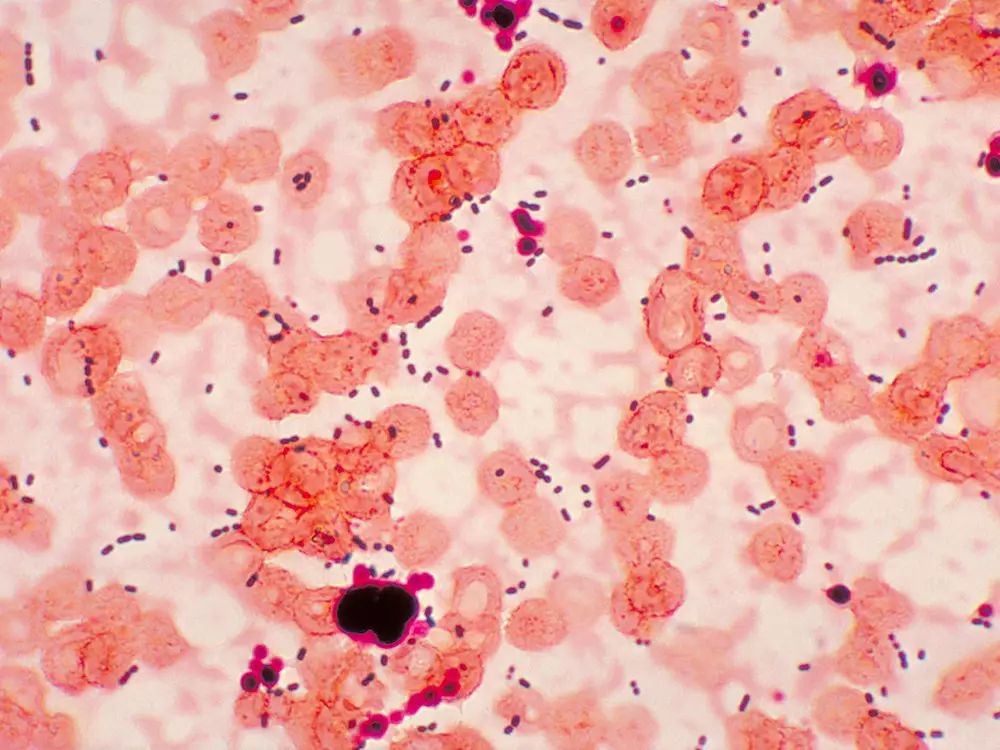 Enterococcus kwayoyin cuta a karkashin microscope