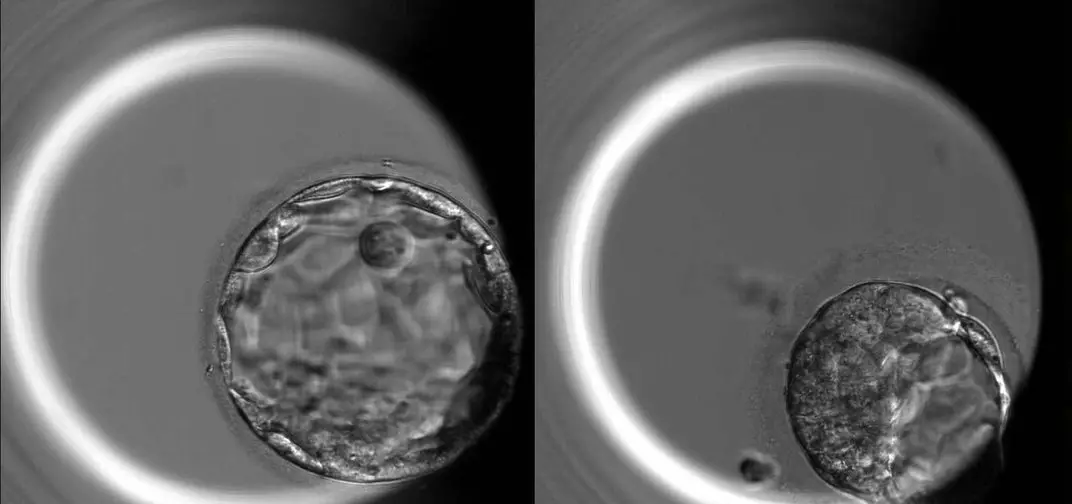 胚胎的基因编辑让我们深入了解基本的人类生物学