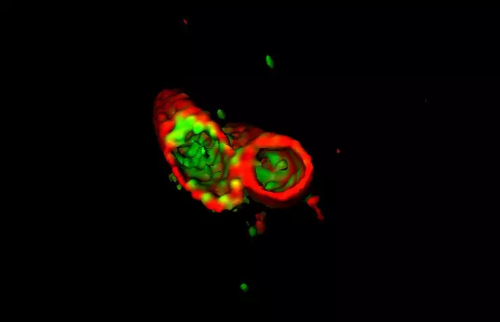 Voordat Salmonella wordt gedood, moet het detergensachtige eiwit APOL3 (groen) door het beschermende buitenmembraan van de bacterie (rood) komen.