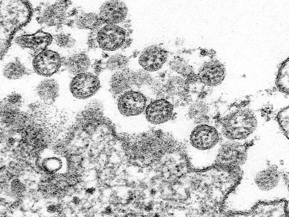 Imatge microscòpica electrònica de transmissió del coronavirus SARS-CoV-2