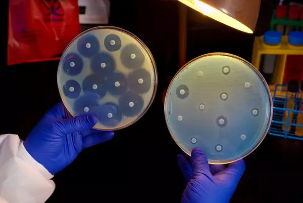 Esto es malo: las "bacterias de pesadilla" son más comunes de lo que pensábamos