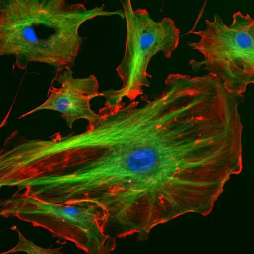 Endothelzellen ënner dem Mikroskop