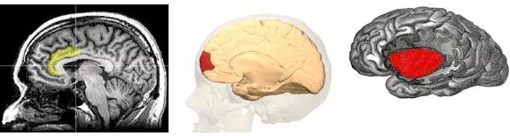 Roger kehilangan korteks cingulate anteriornya