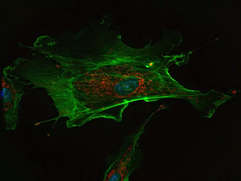 Els metges sondegen els cossos amb petits microscopis però no saben què estan veient