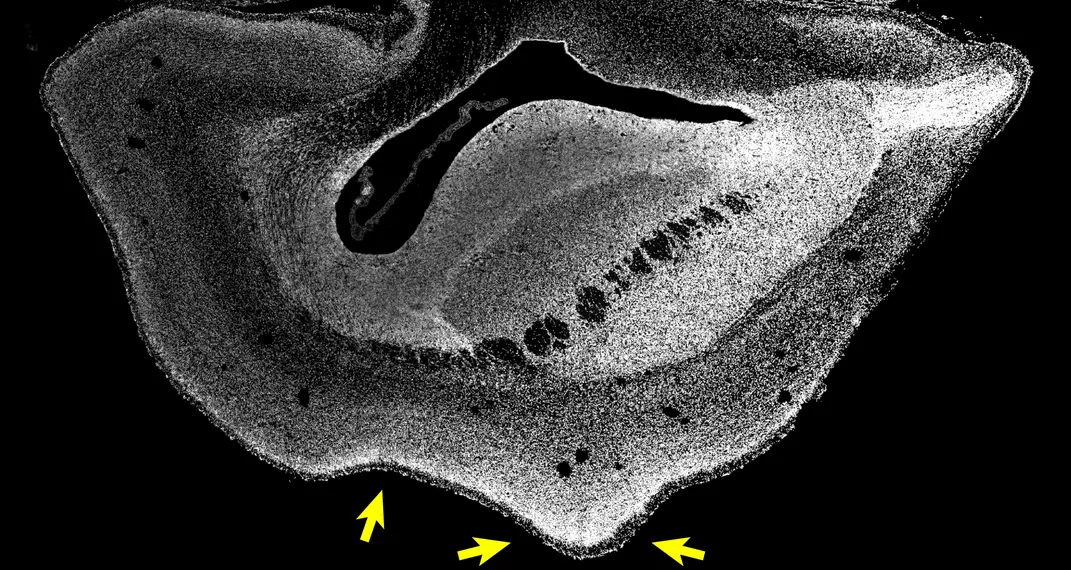 Mikroskopyôfbylding fan it brein fan marmoset