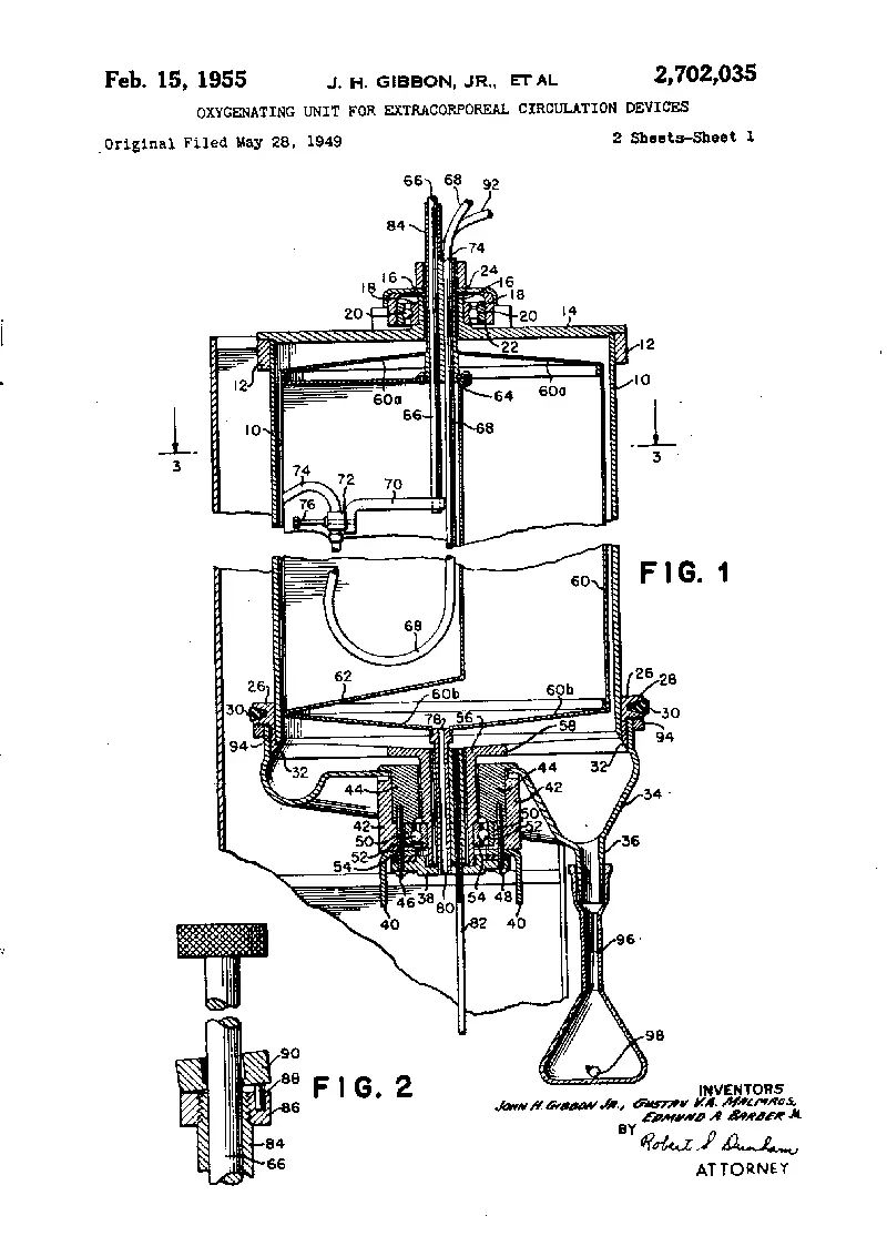 1950 کی دل اور پھیپھڑوں کی اس مشین نے کارڈیک سرجری میں انقلاب برپا کیا۔