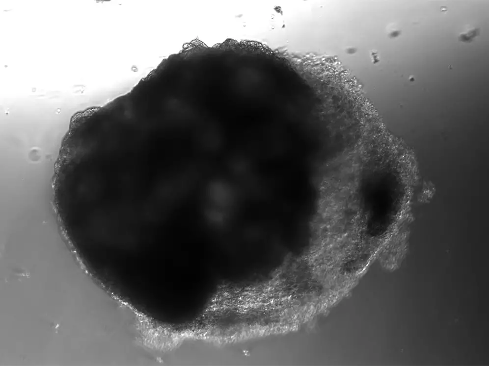 خراب شدہ کارڈیوڈ کی ایک متحرک تصویر ایک طرف سیاہ ہے، جو دھڑک رہی ہے، اور دوسری طرف روشنی، جہاں خلیے مر چکے ہیں۔