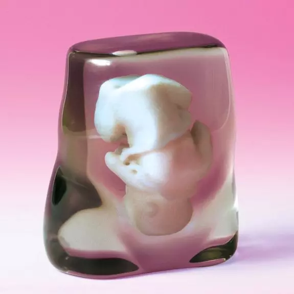 Bakit Kinakatawan ng Mga Naka-print na 3-D na Fetus ang Kinabukasan ng Medical Imaging
