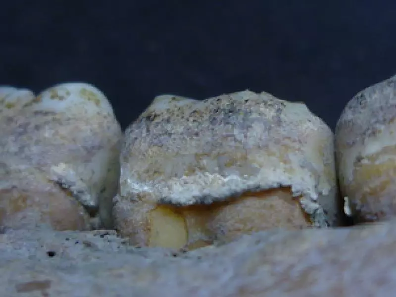 Новая тэхніка вывучэння старажытных зубоў паказвае дыету эпохі Эда ў Японіі