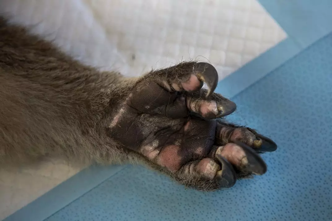 Ein Koala im Krankenhaus hat rosa Flecken auf seiner Pfote, die geheilte Brandstellen sind.