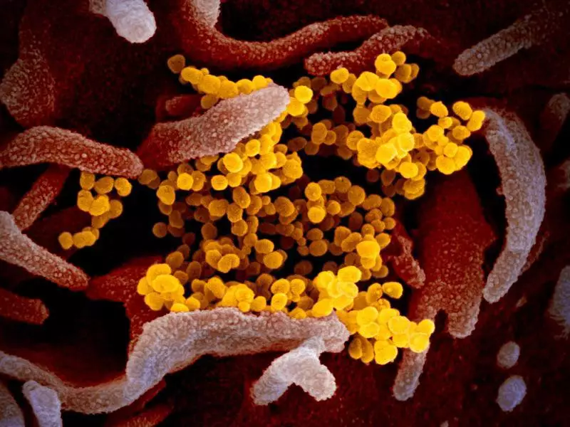 Perché l'immunità al nuovo coronavirus è così complicata