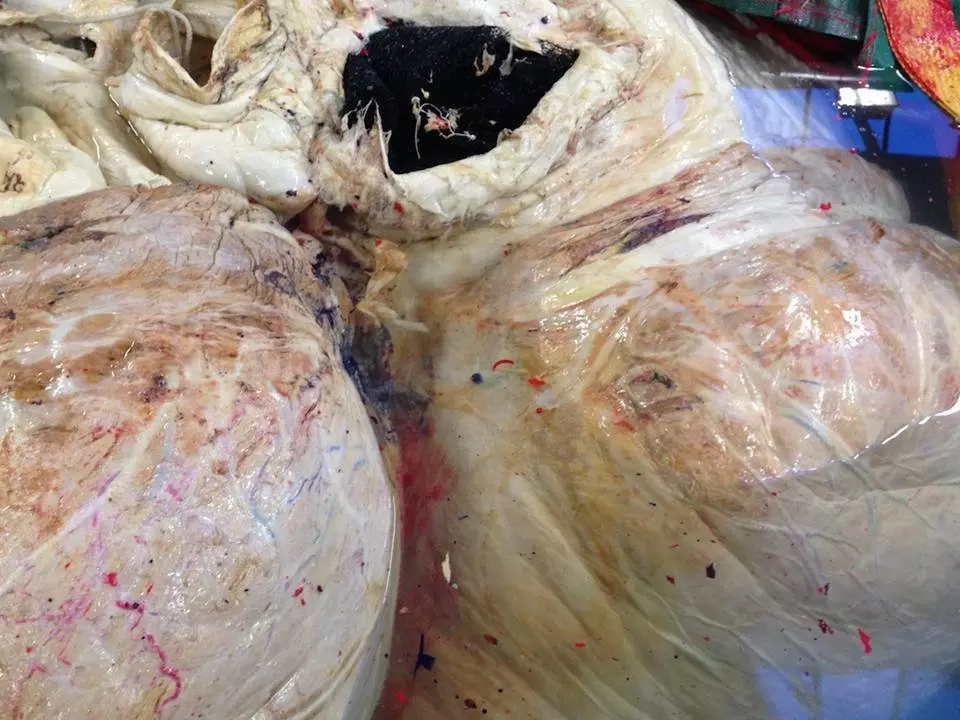 400ポンドのシロナガスクジラの心臓を保存するための骨の折れるプロセス 29676_8