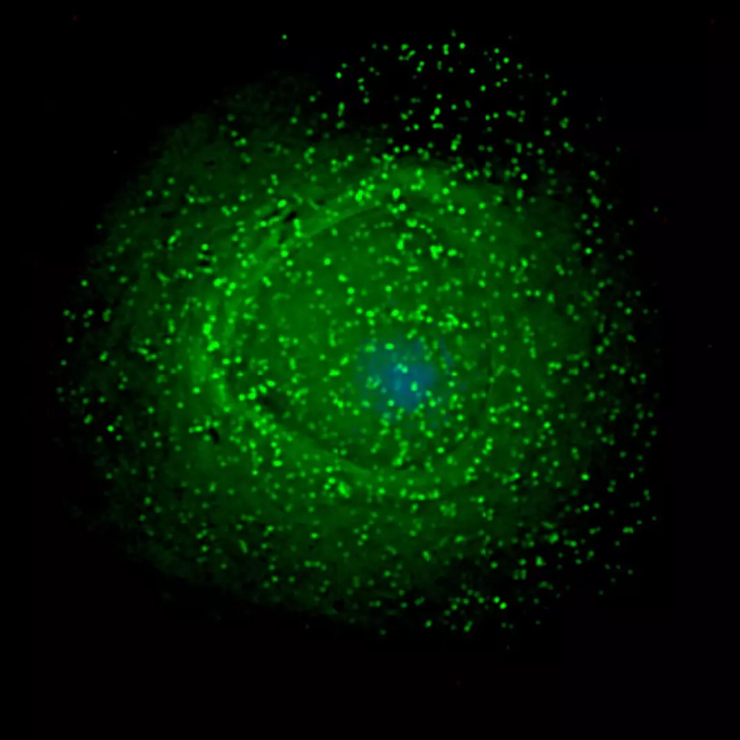 HIV巨噬细胞