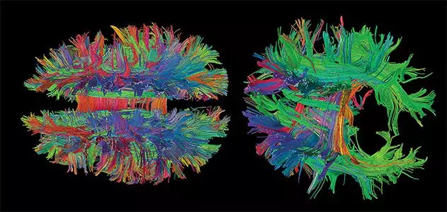 Magnetic resonance imaging