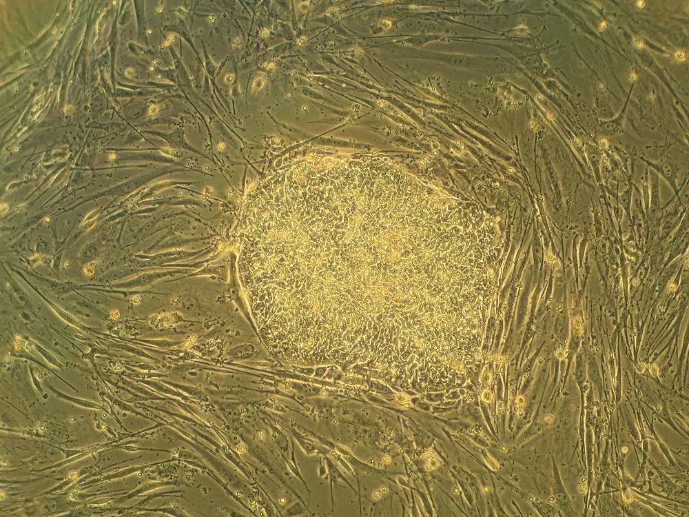 Ľudské embryonálne kmeňové bunky v bunkovej kultúre