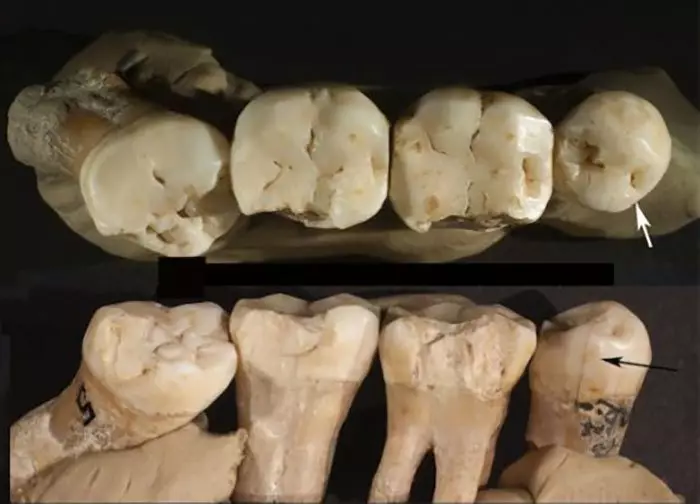 Neandertāliešu zobi