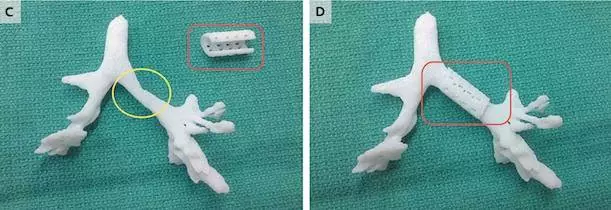 Giondriddo'nun trakea ve bronşlarının, atelin sağdaki görüntüye yerleştirdiği 3D baskılı dökümü.