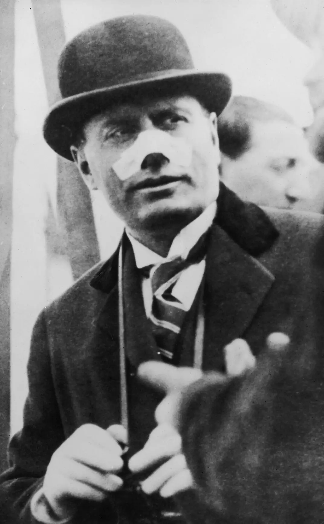 En svartvit närbild av Mussolini, en vit man i bowlerhatt och kostym och slips, med ett stort vitt bandage över näsan