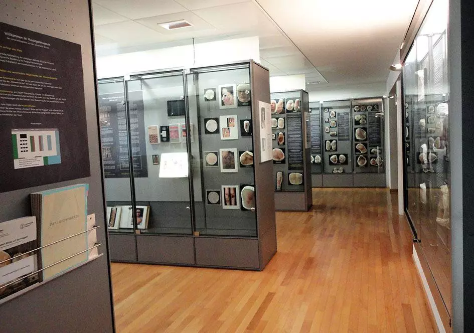 Vaadake selles Šveitsi meditsiinilise moulage muuseumis üle 2000 nahahaiguste vahamudeli 33112_11