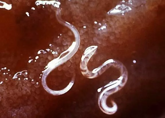 Parasitic hookworms nyob rau hauv tib neeg txoj hnyuv kab mob.