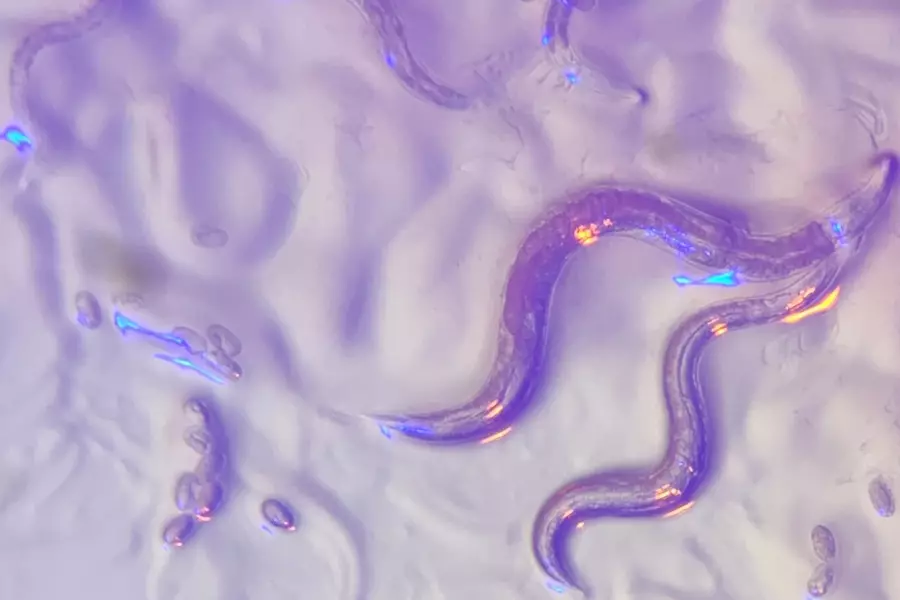 Fọto ti nematodes ti a wo labẹ maikirosikopu nibiti wọn ti han eleyi ti