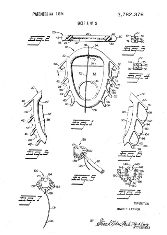 Soti nan Paria Medikal rive nan Icône Feminis: Istwa IUD la