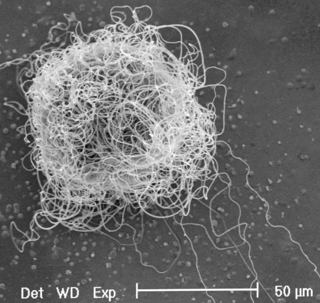 Iyo Yakareba, Inopepo Tale yeSperm Science